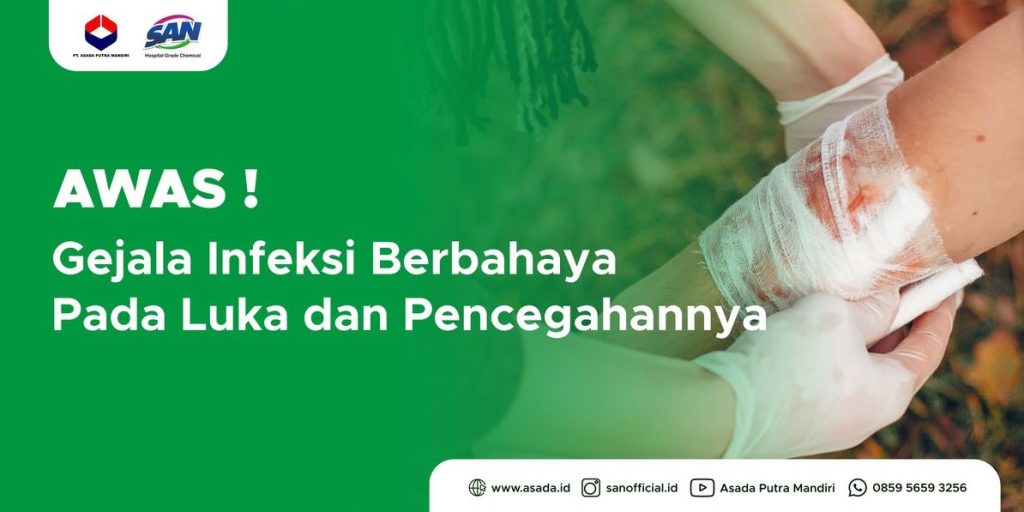 Awas ! Infeksi Berbahaya Pada Luka dan Pencegahannya